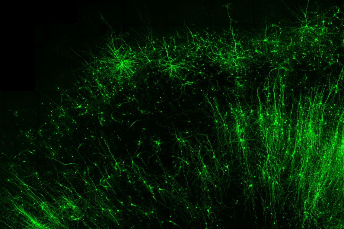 New RNA-Based Tool Can Illuminate Brain Circuits, Edit Specific Cells ...
