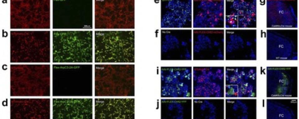 Yin Lab | Duke Neurobiology